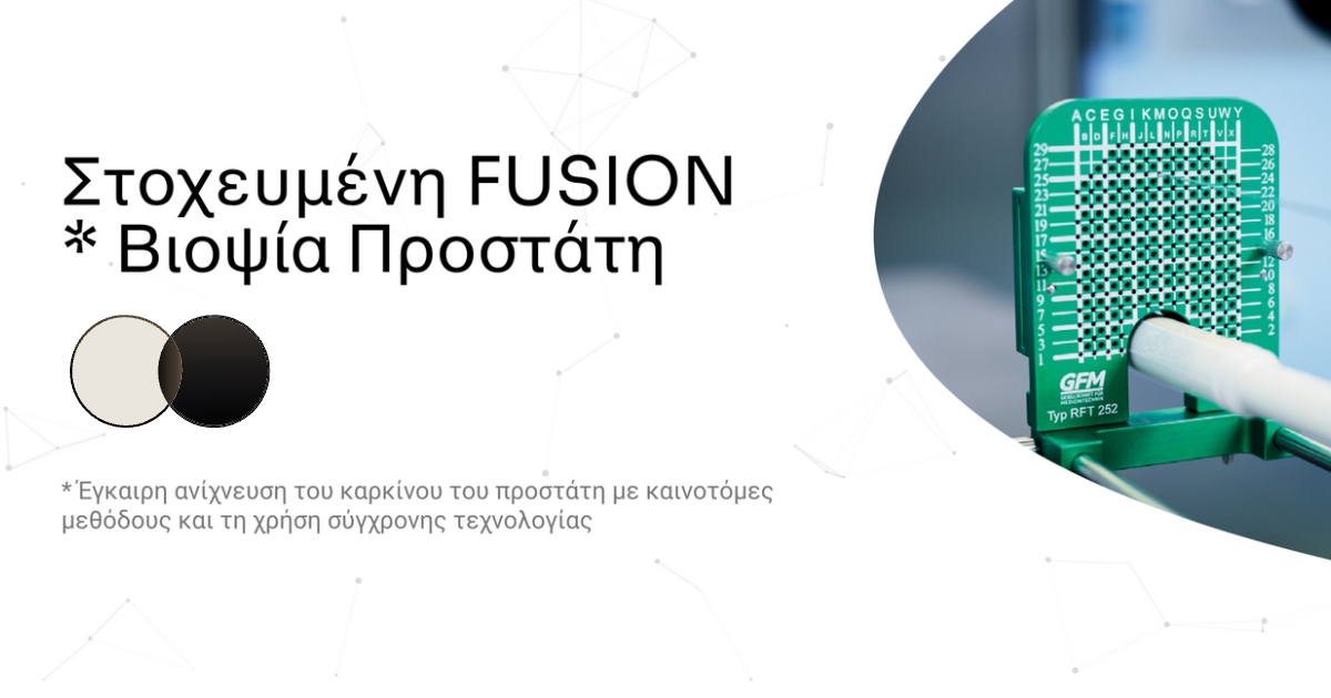 FusionBio - Fusion Βιοψία Προστάτη